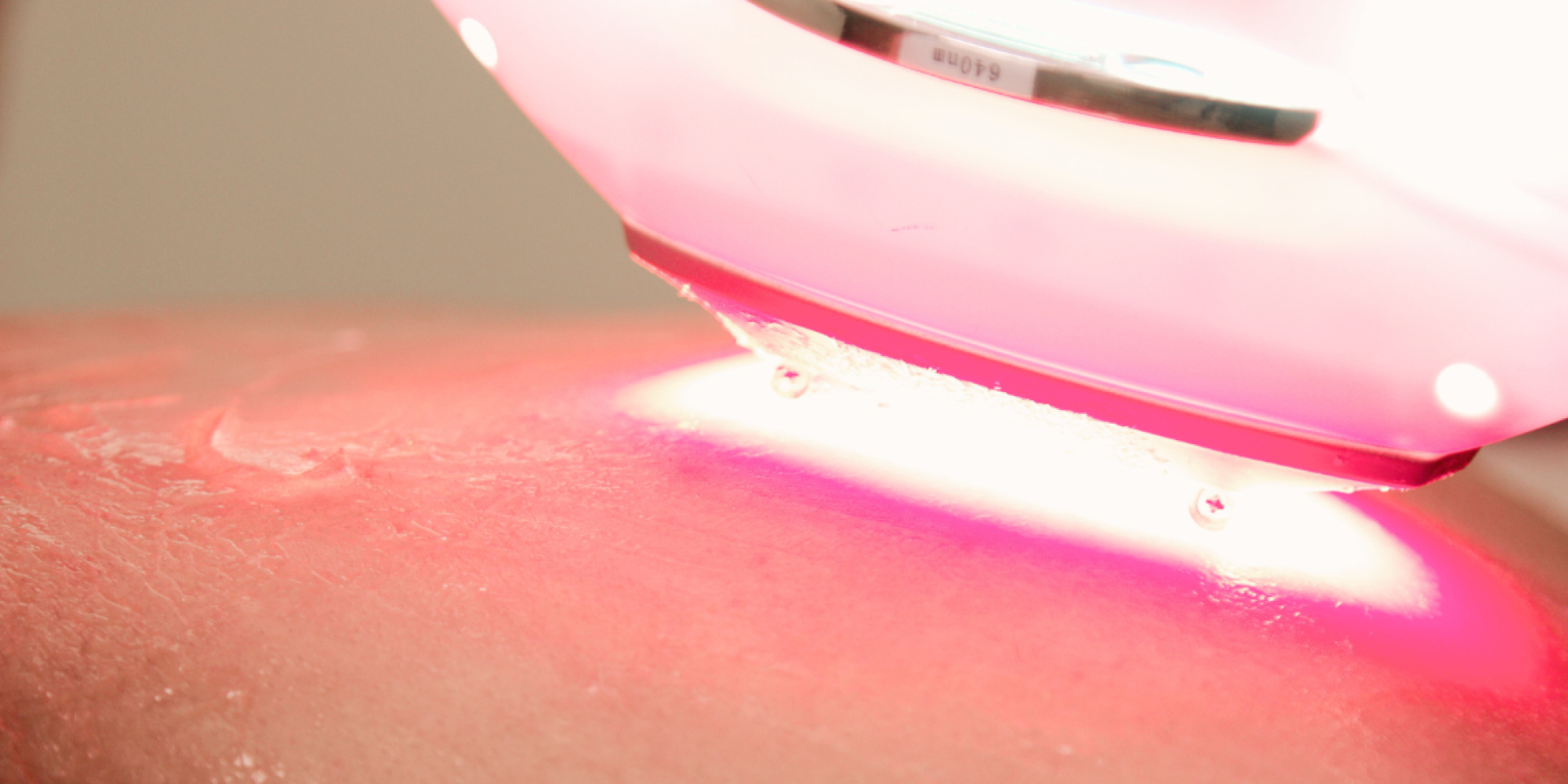 Photobiomodulation Therapy (PBM) | Harnessing the Healing Power of ...